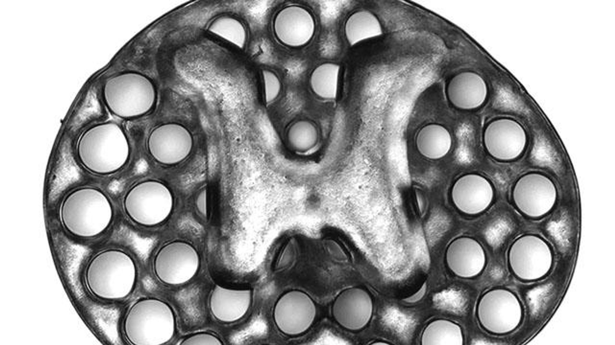 3D printing helps heal spinal cord injuries in rats | Science, Climate ...