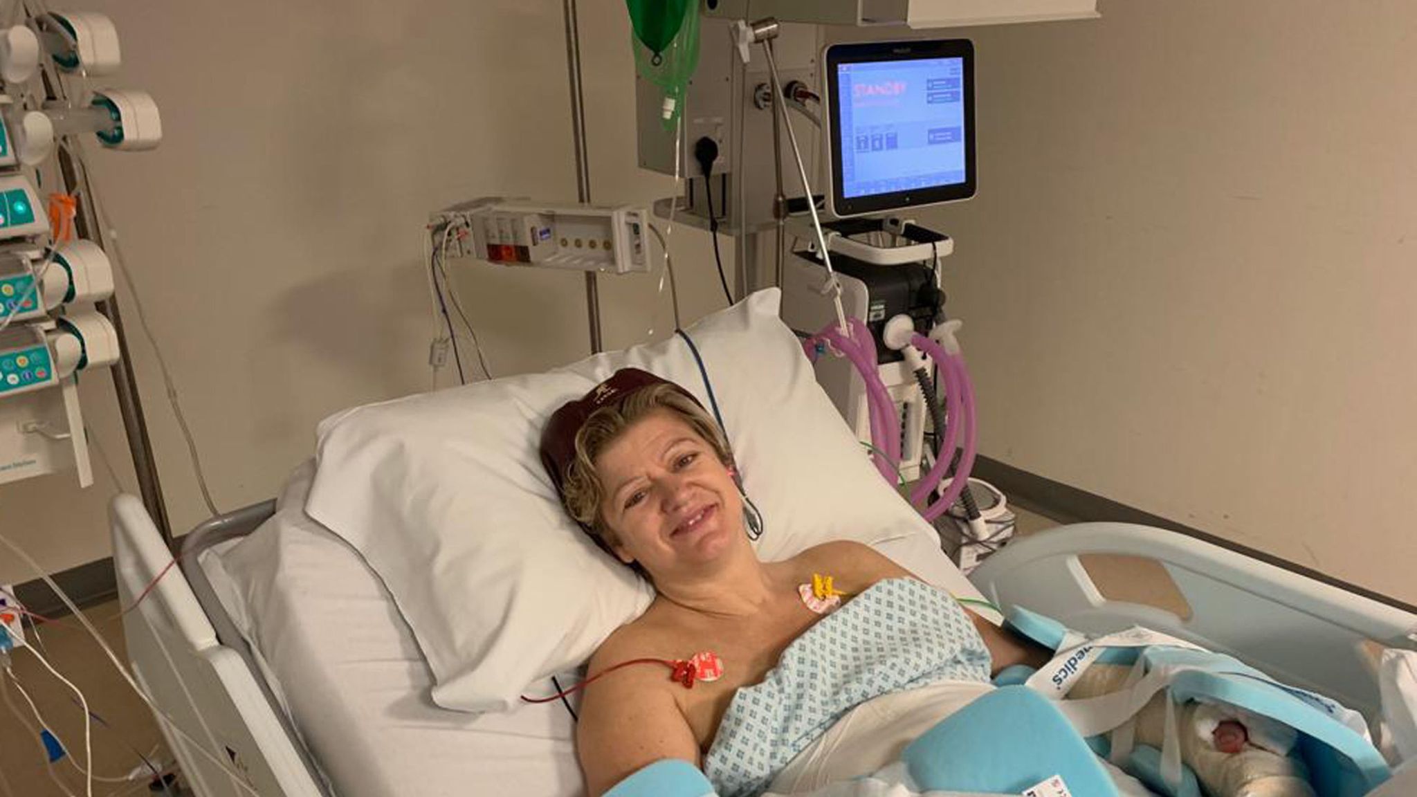 Quadruple amputee Corinne Hutton given double hand transplant | UK News ...