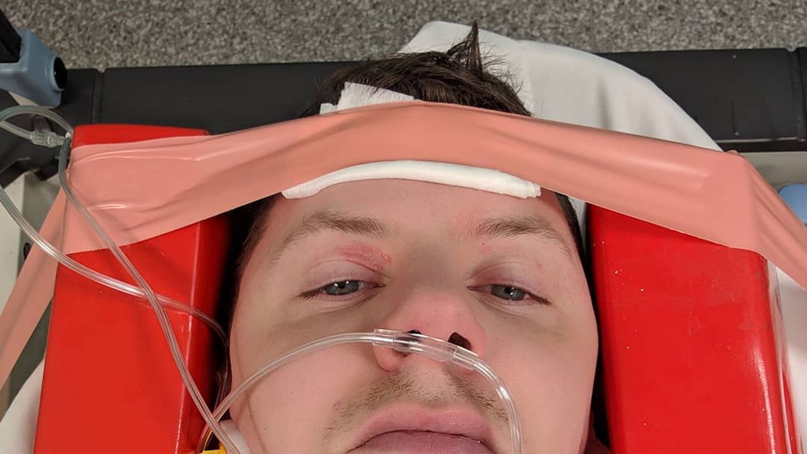 Professor Green cancels tour after suffering seizures and fracturing ...