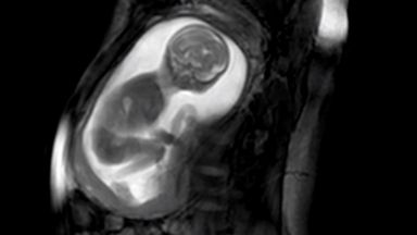 Groundbreaking images of unborn baby in womb | Science, Climate & Tech ...