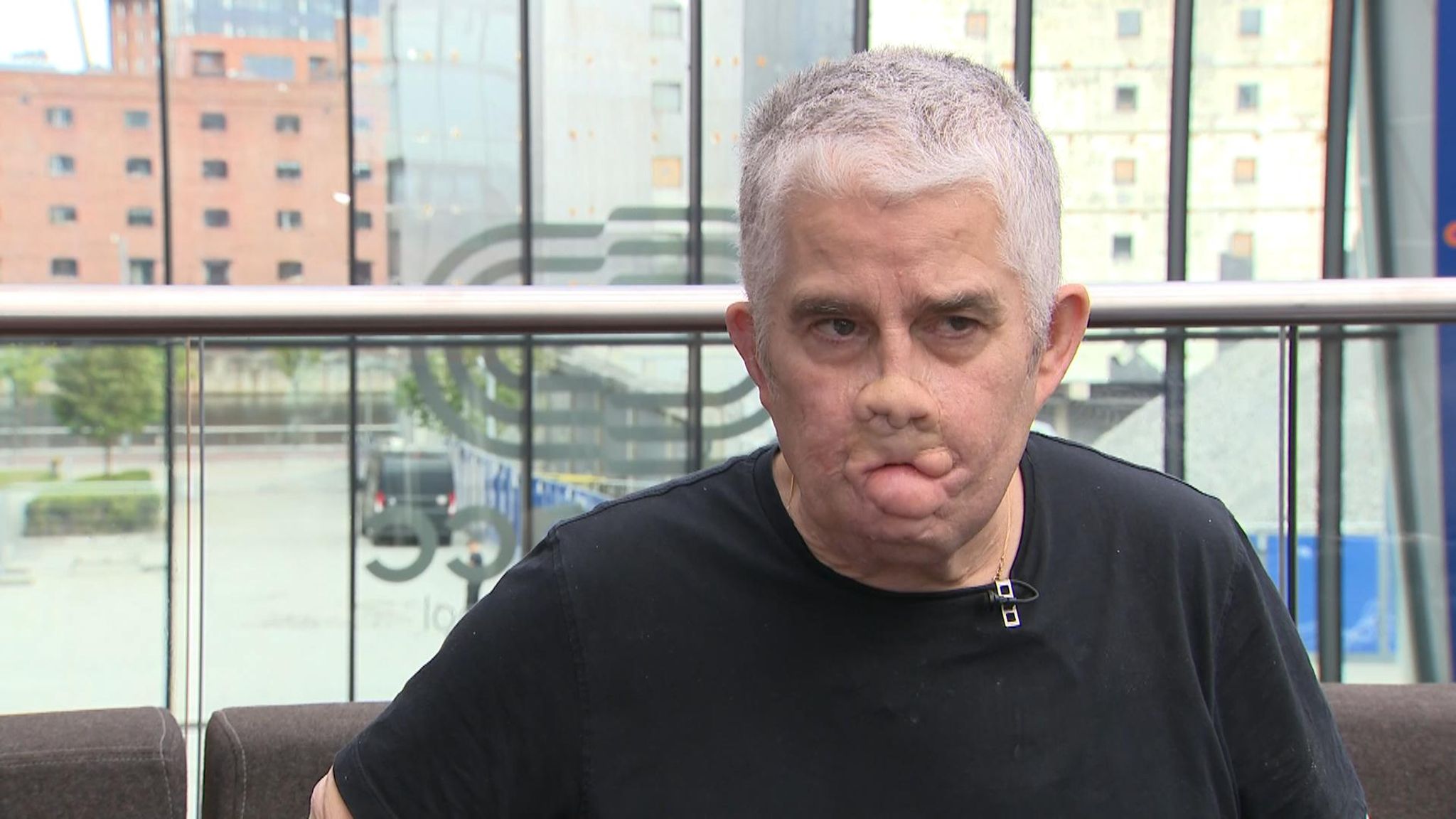 Having sepsis 'was like dying and coming back to life' | UK News | Sky News