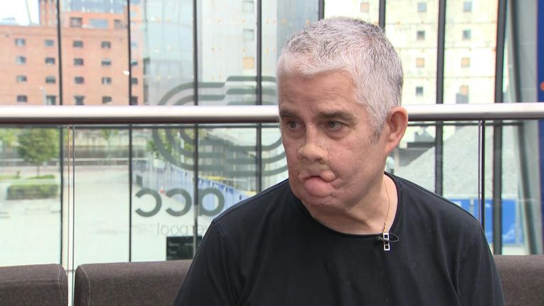 Having sepsis 'was like dying and coming back to life' | UK News | Sky News