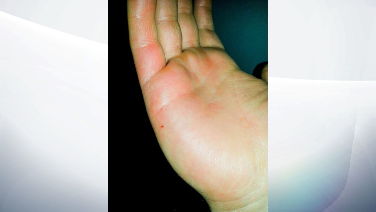 Firefighter gets £1.5m after losing hand in training exercise | UK News ...