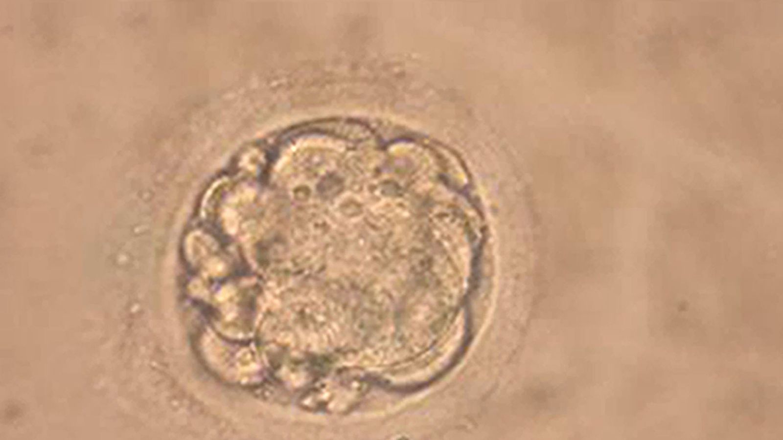 New project to unlock the secrets of how human embryos develop ...