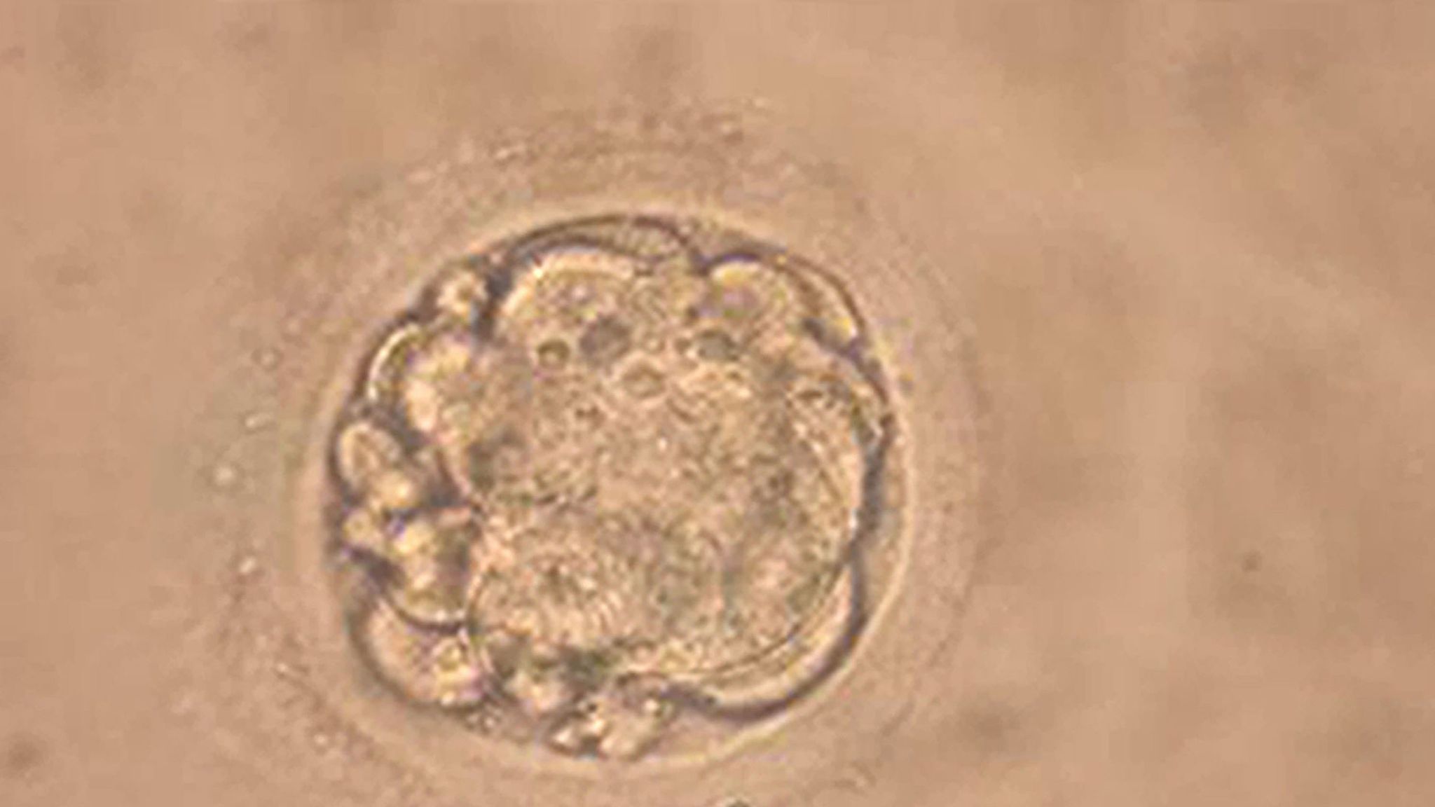 New project to unlock the secrets of how human embryos develop ...