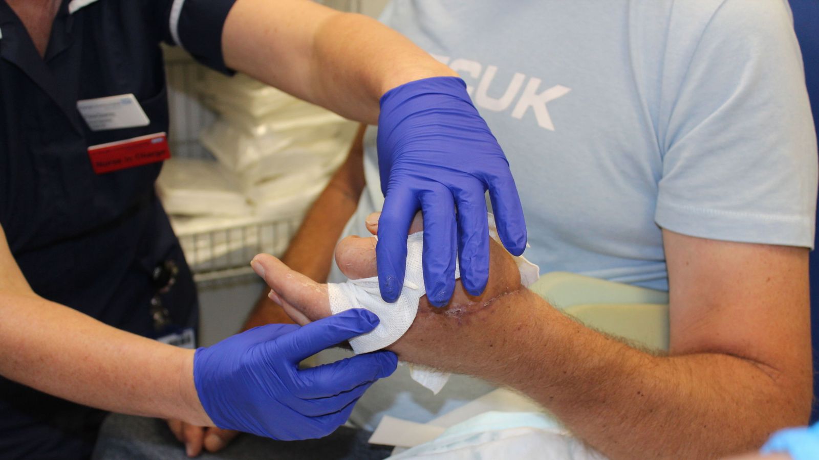 Surgeons save man's hand by attaching it to his groin for two weeks ...