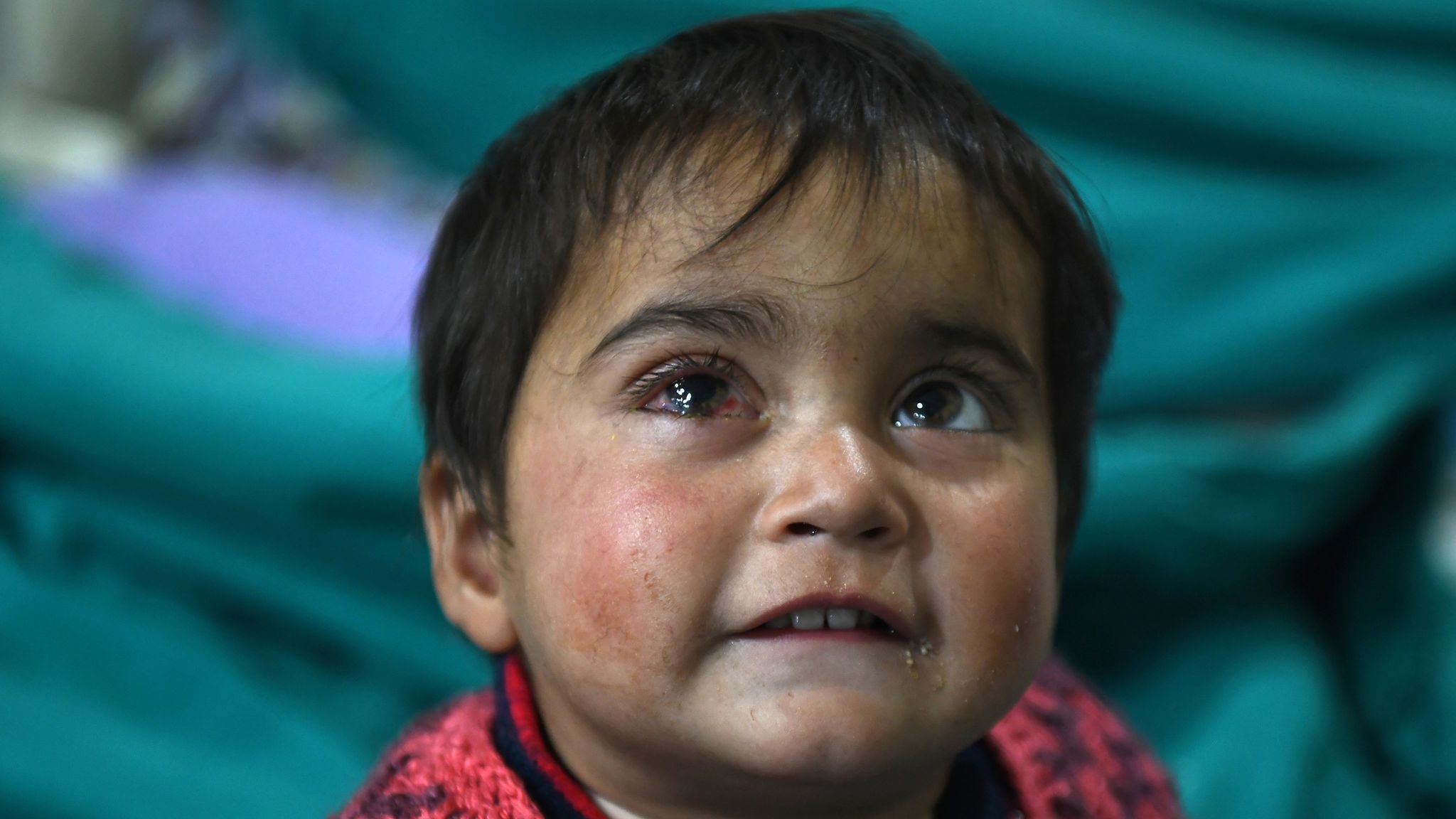 New gene therapy on the NHS will save the sight of kids threatened with ...