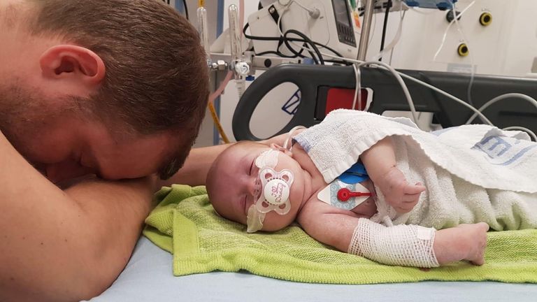 Baby dunked in icy water after heart rate rises to 320 beats per minute ...