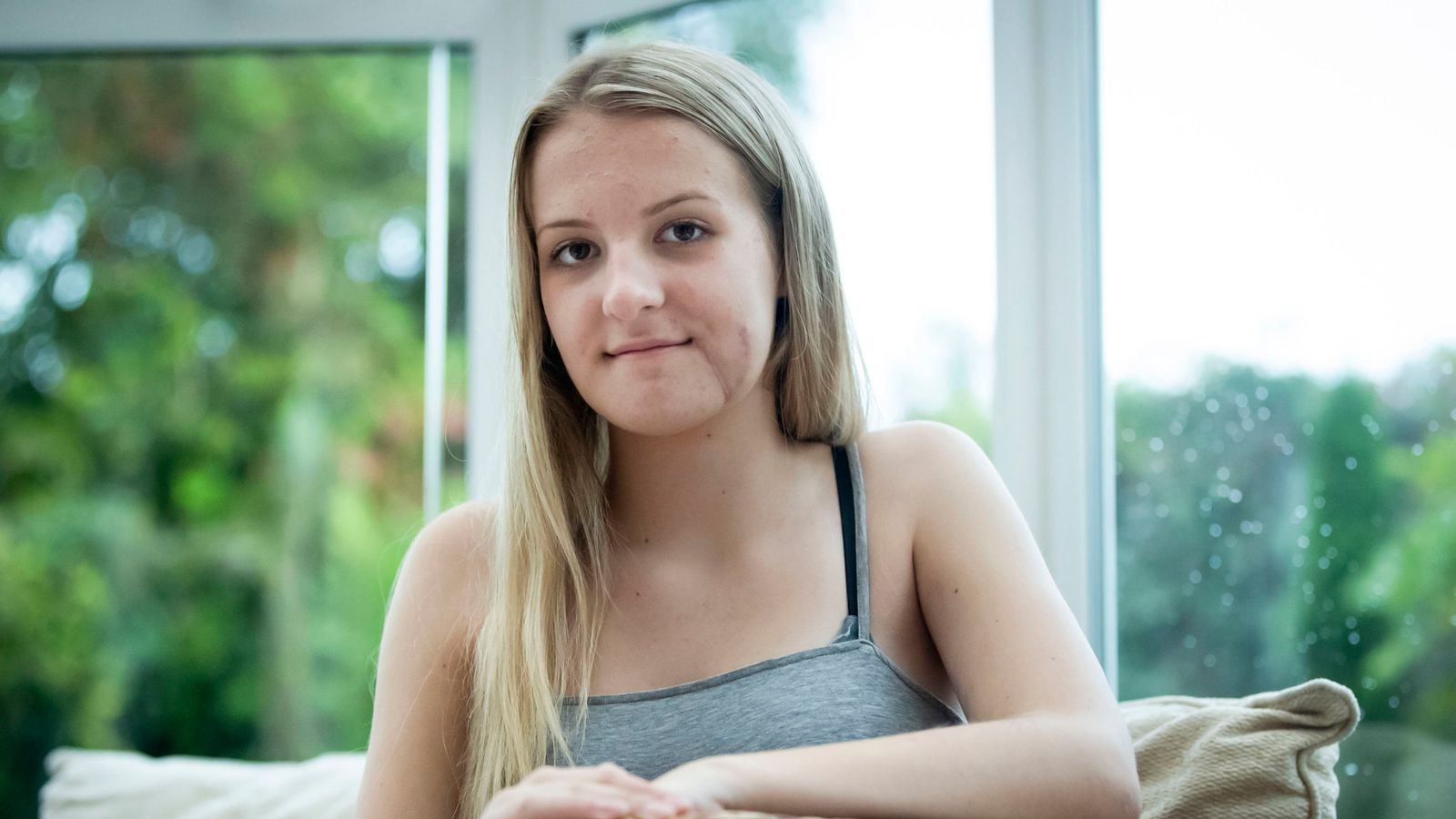 Girl's jaw hung by 1cm of skin after horse riding accident | UK News ...