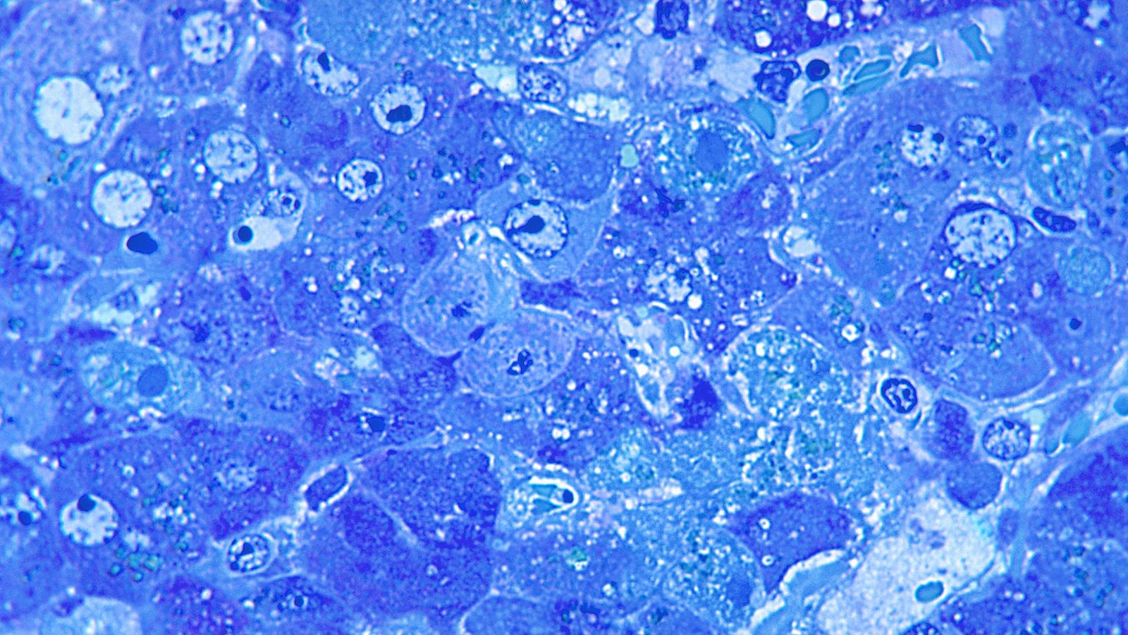 Lassa fever: Britons who came into contact with victims brought back to ...