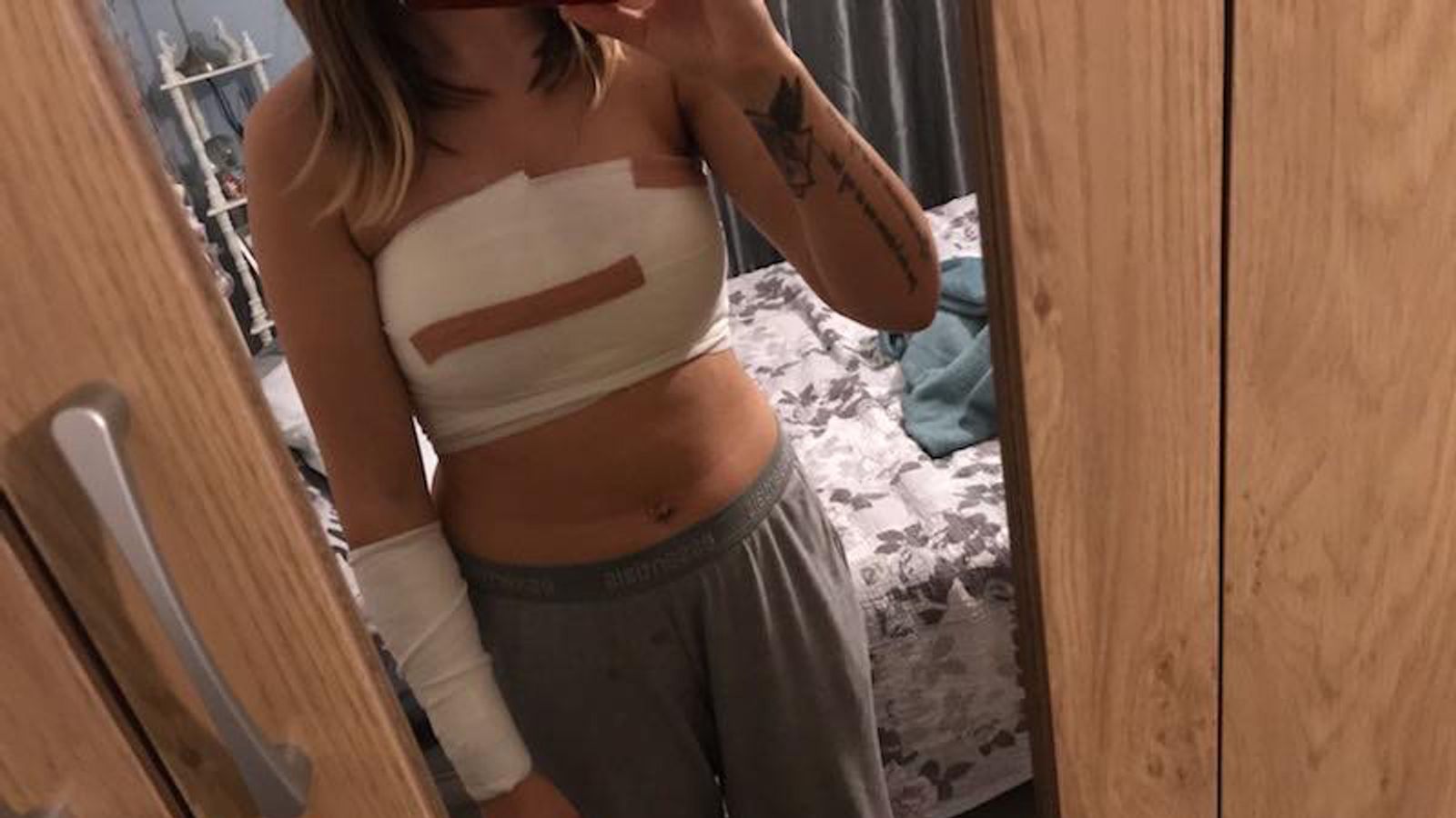 Liam Gallagher reaches out to fan 'scarred for life' by flare at one of his gigs | Ents & Arts ...