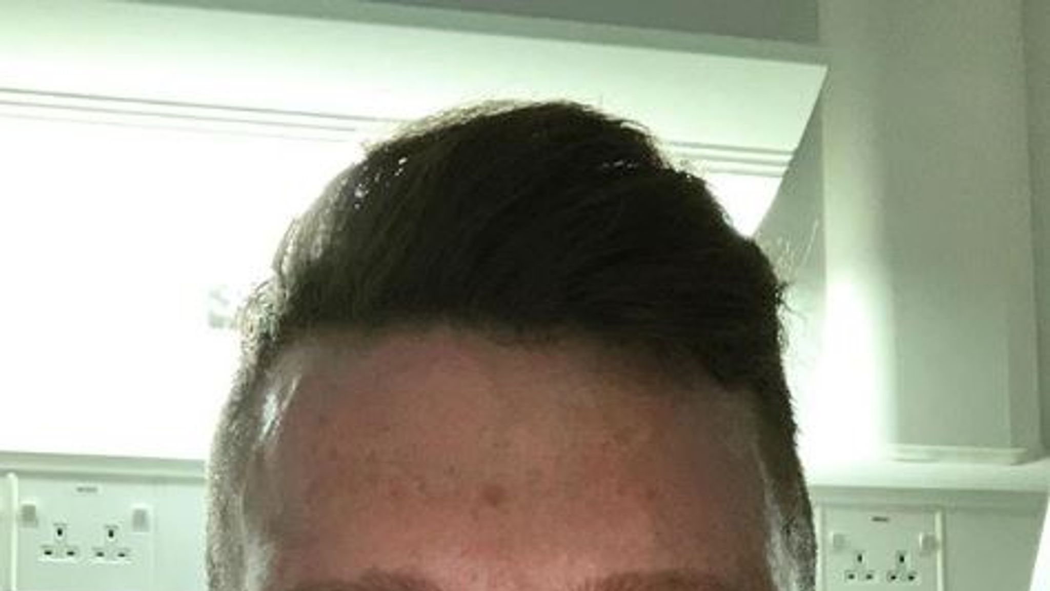 Sam Ward: Great Britain hockey star loses most of sight in left eye ...