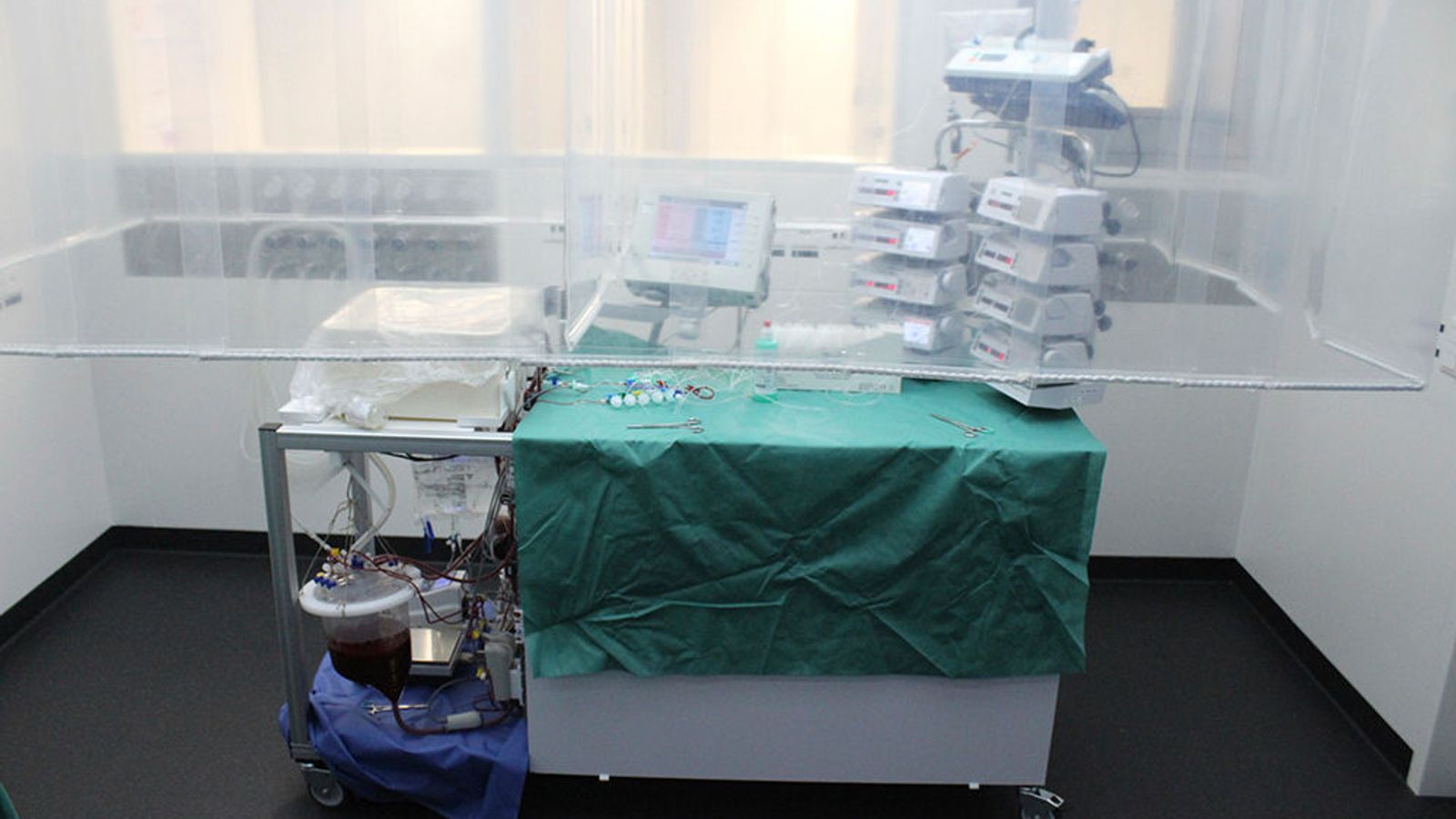 Liver kept alive outside a body for a week by scientists with perfusion ...