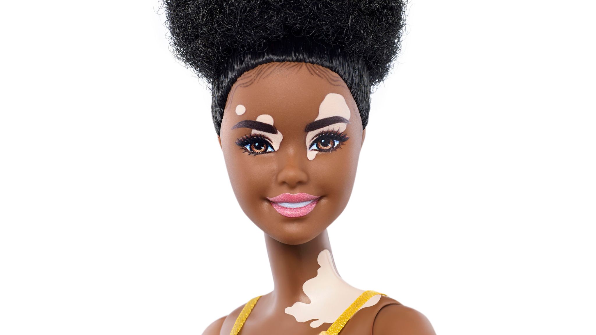 Barbie dolls with no hair and vitiligo aim to diversify iconic toy ...