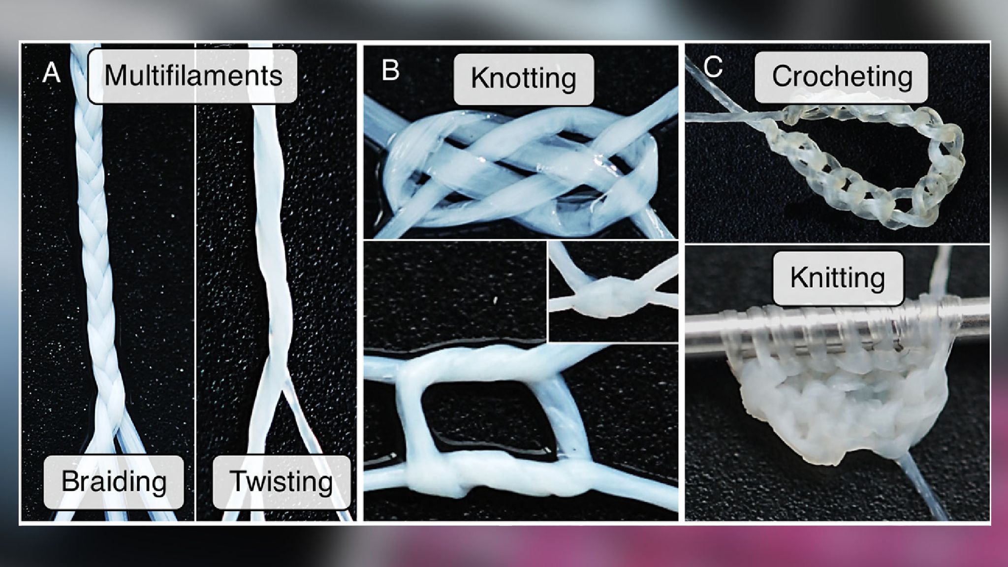 Yarn made from human skin could be used to stitch surgery patients ...