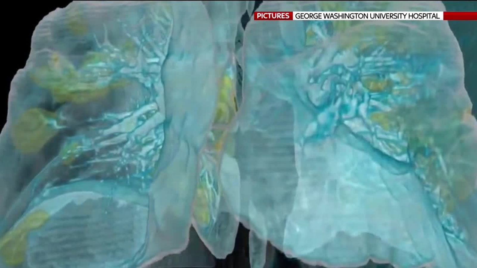 How does coronavirus attack the body? | Science & Tech News | Sky News