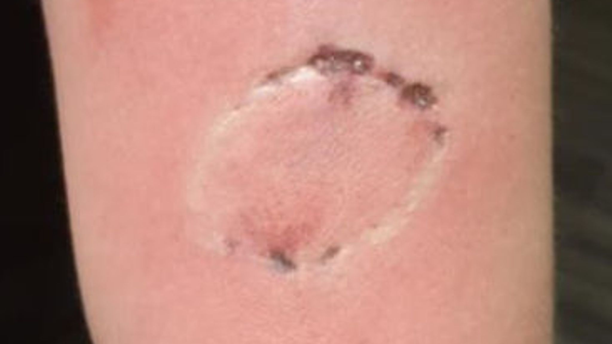 Coronavirus: Policewoman bitten on the arm while explaining COVID-19 ...