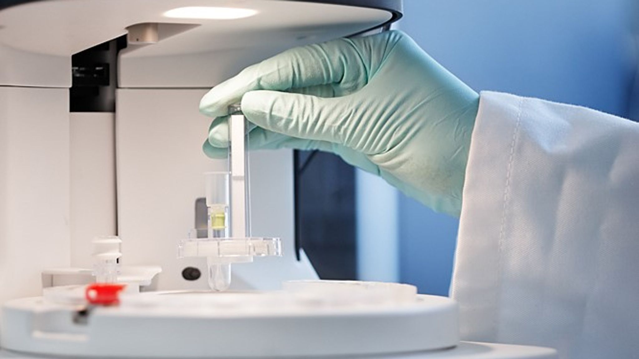 Coronavirus: 90-minute COVID-19 test with 98.7% accuracy to be rolled ...