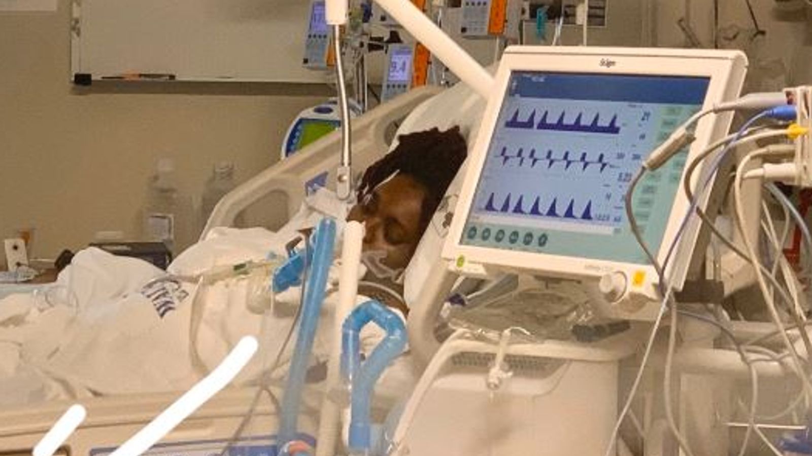 Coronavirus: 'She took her last breath in my arms' - A personal tragedy ...