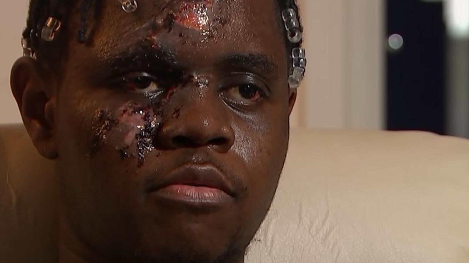 Race attack victim: ‘We can’t keep living like this’ | UK News | Sky News