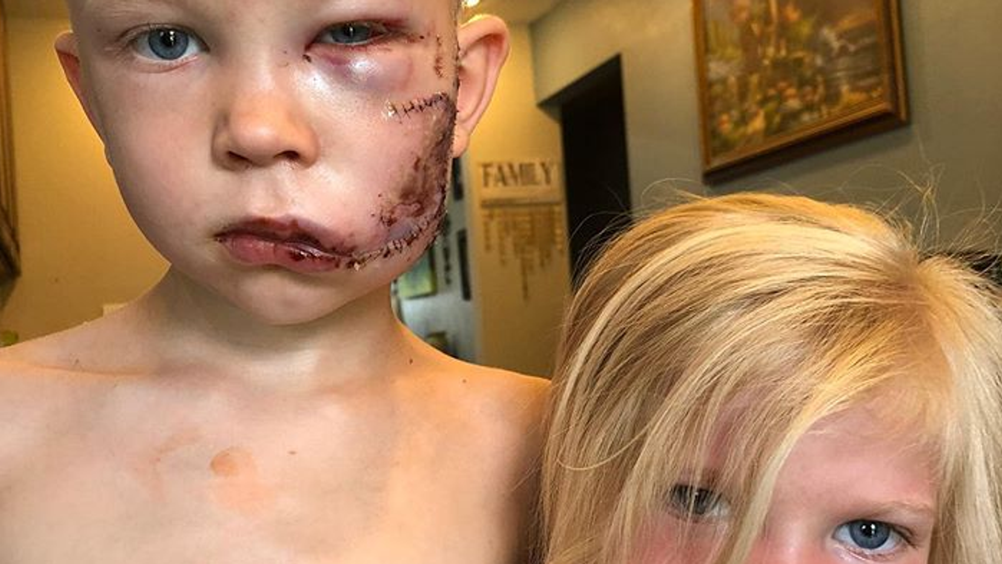 'Pal, you're a hero': Boy, 6, who saved sister from dog attack gets ...