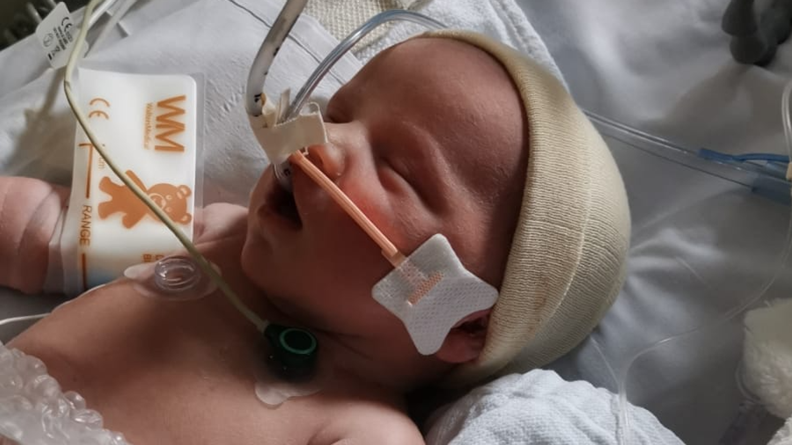 Our baby died during lockdown - it affected our grief in so many ways ...