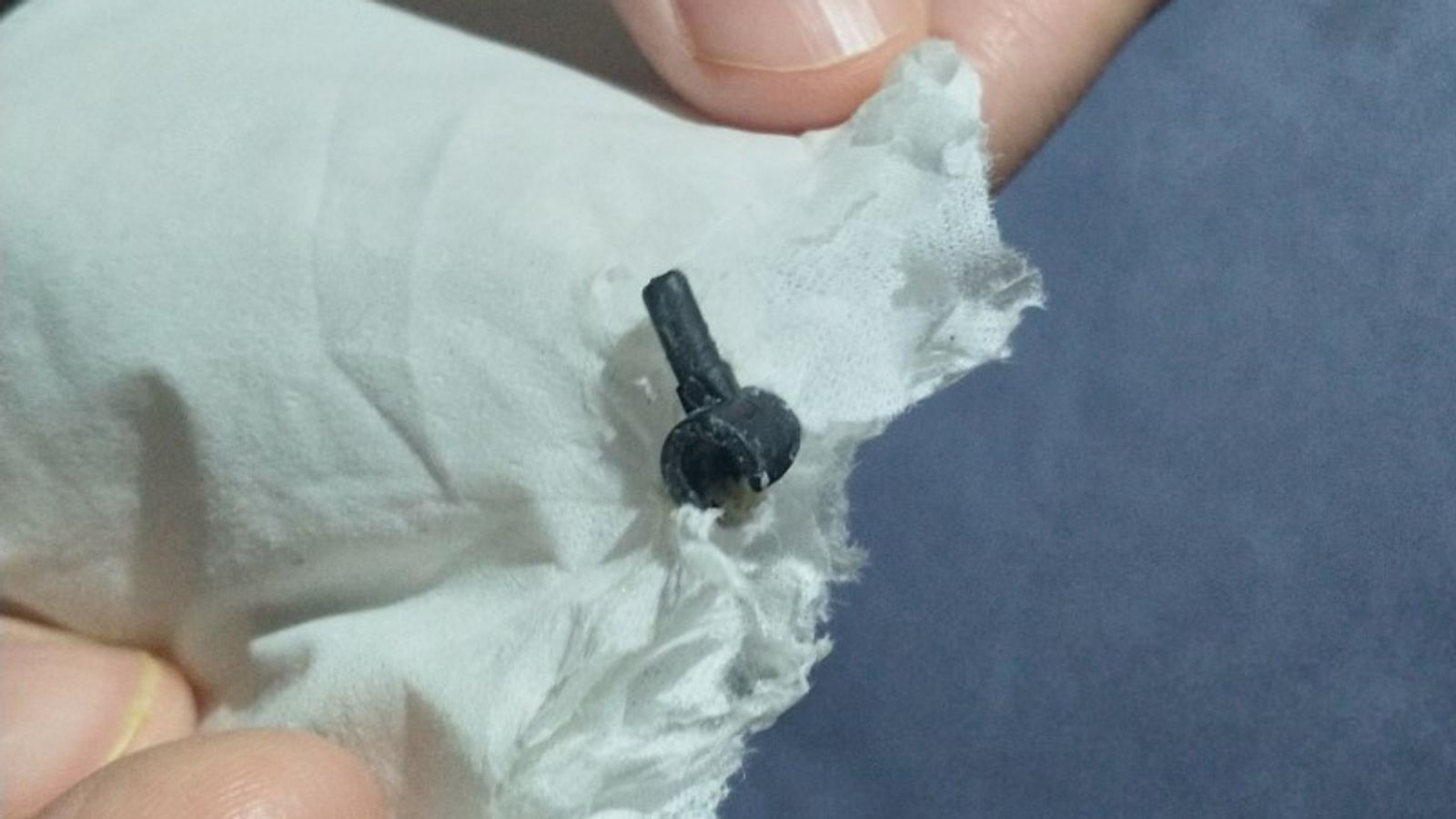 Lego piece falls from boy's nose after being stuck for two years ...