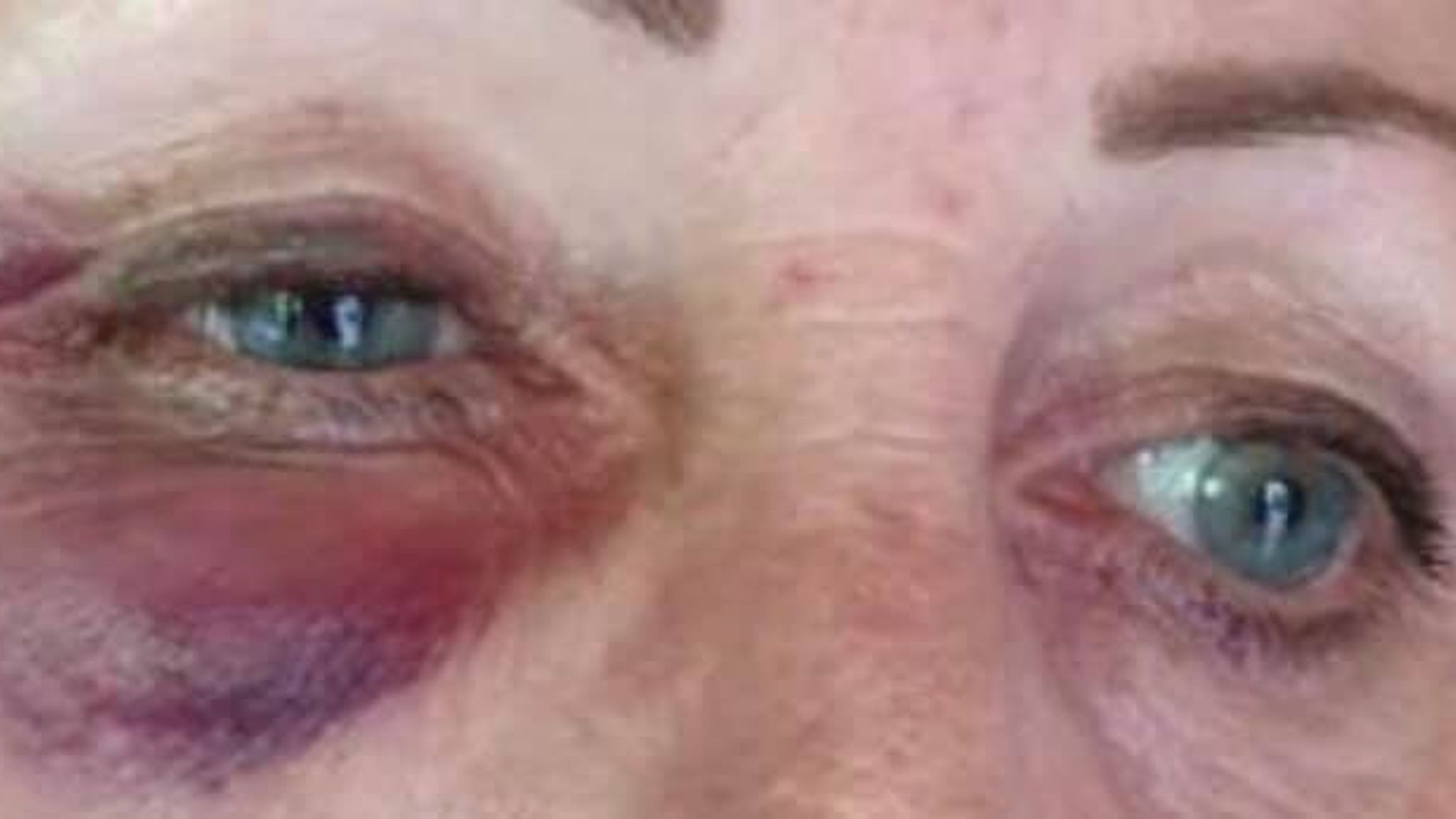 Tougher sentences for assaults on emergency workers as maximum jail ...