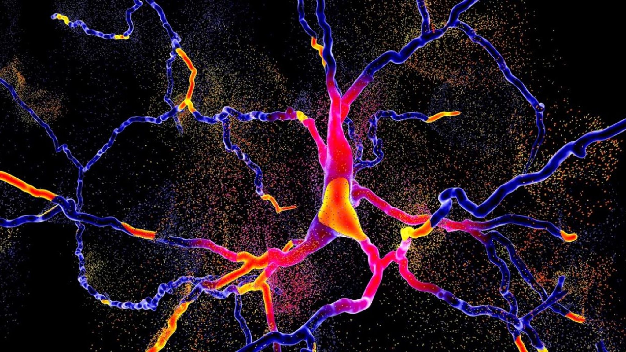 Parkinson's disease: Scientists take 'vital step' towards finding a ... Parkinson's disease: Scientists take 'vital step' towards finding a ...