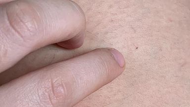 'Terrified' women describe blackouts and sickness after suspected ...