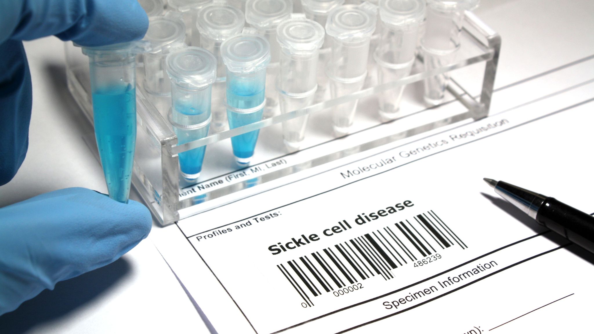 Sickle cell disease: MPs call for major changes after inquiry report ...