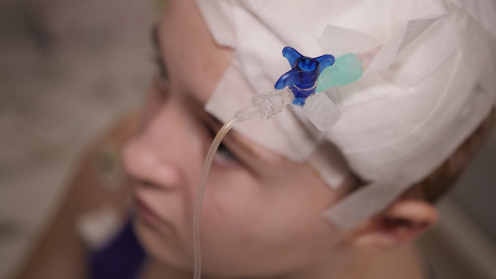 Ukraine war: Teenage girl recovering after shrapnel blasted through her ...