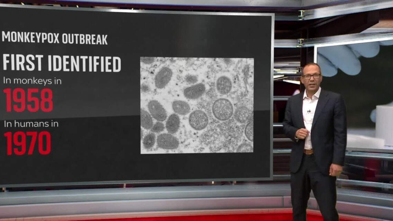 Monkeypox: What do we know? | UK News | Sky News