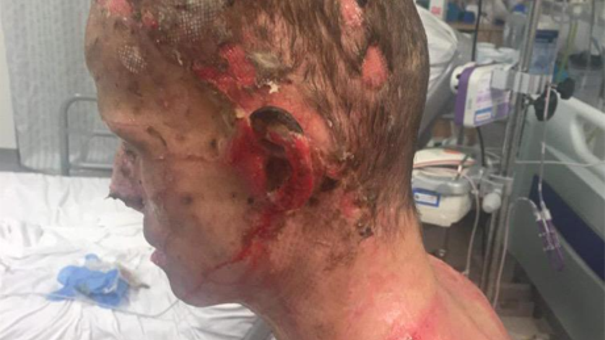 'Desperate' man was 'dead for two minutes' after being electrocuted ...