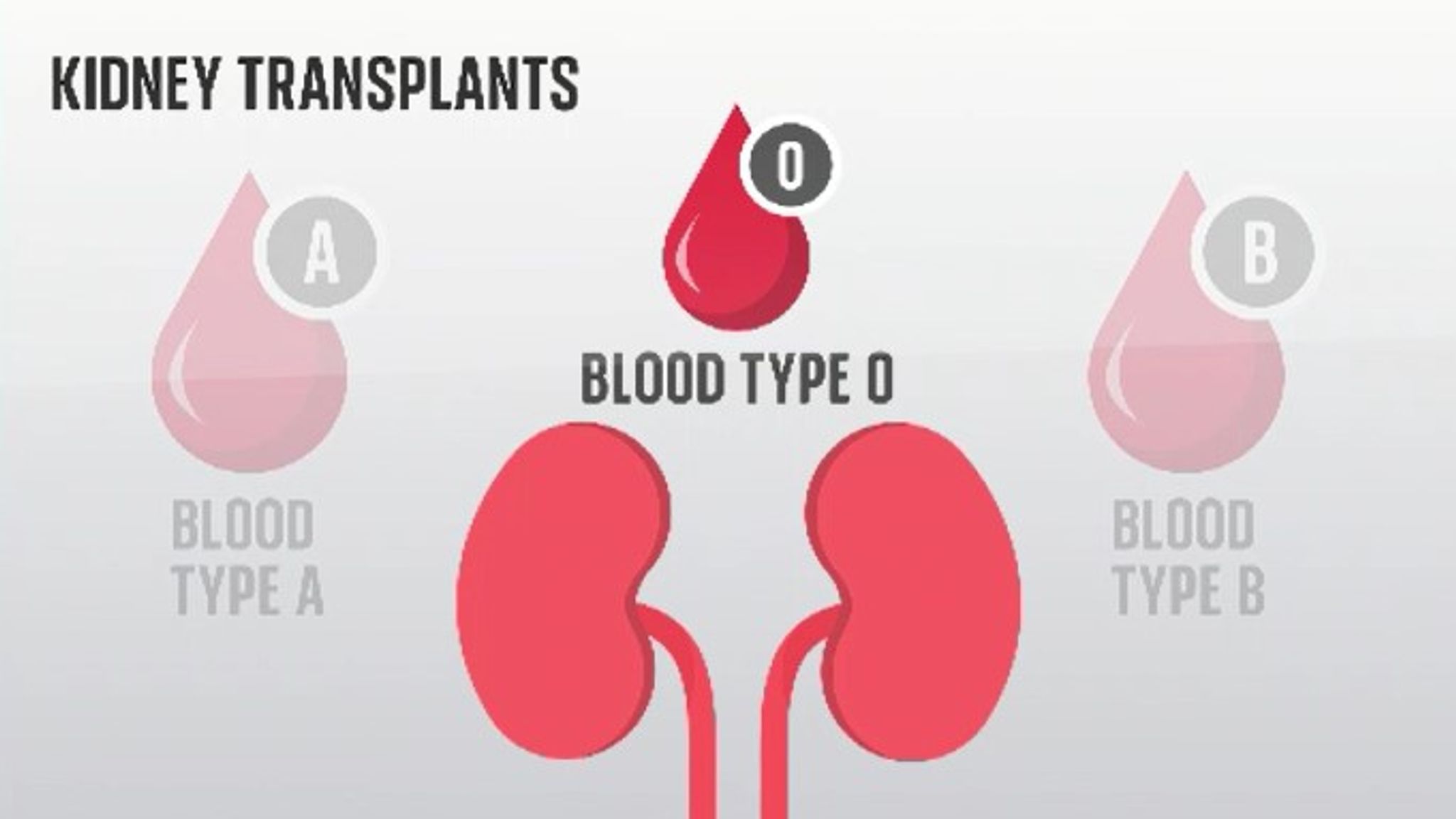Transplant hope for minorities as scientists successfully alter donor ...