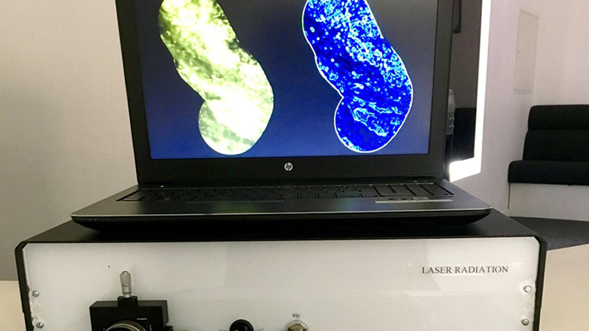 New tiny microscope 'could speed up breast cancer treatment' and cut ...