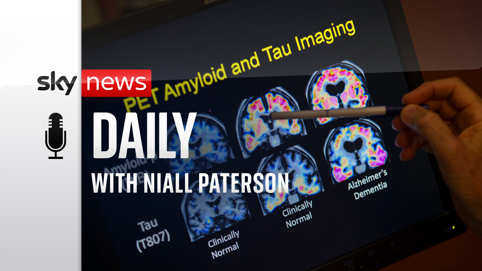 New Alzheimer's drug: How much of a breakthrough is it? | Science ...