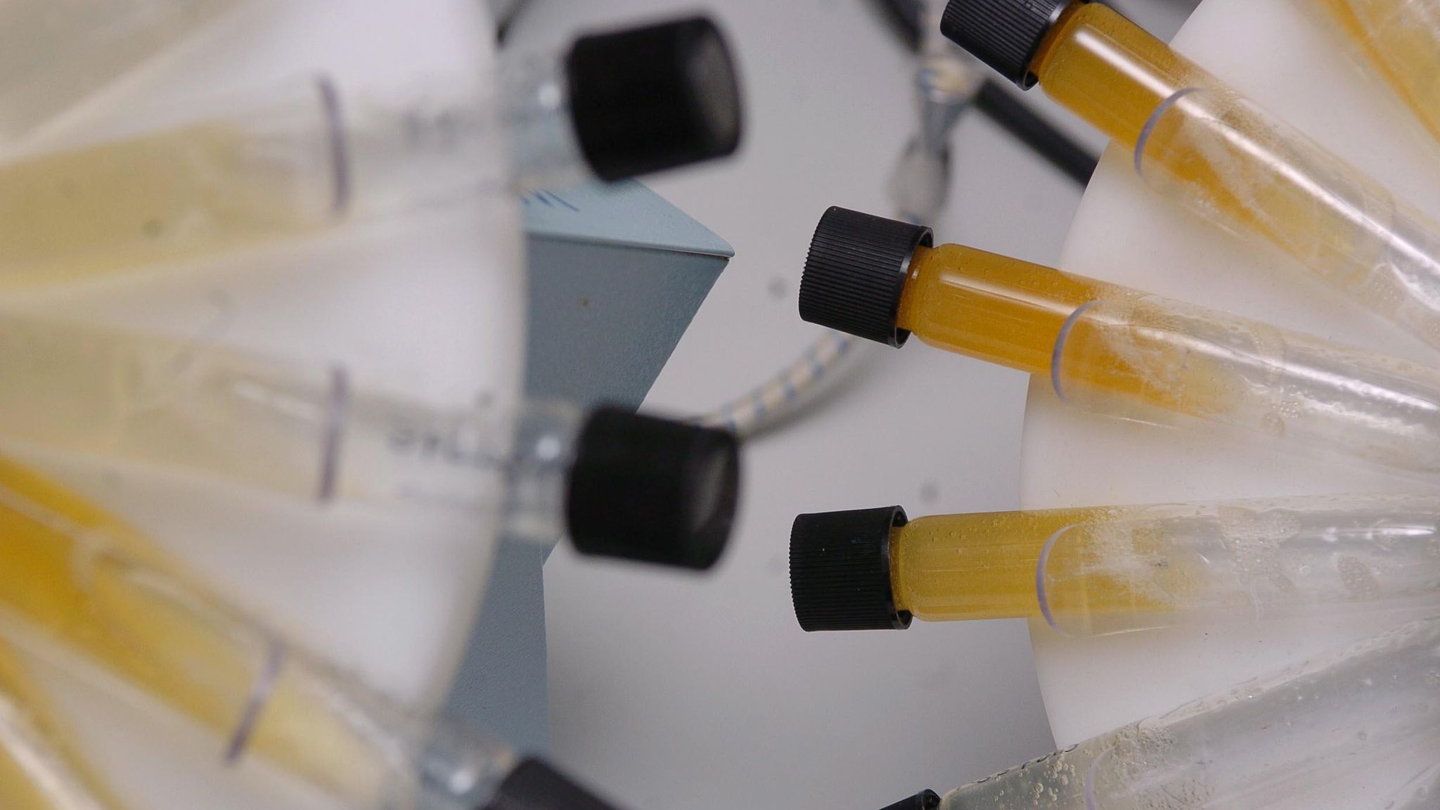 Urine test for liver cancer a step closer after Glasgow scientists ...