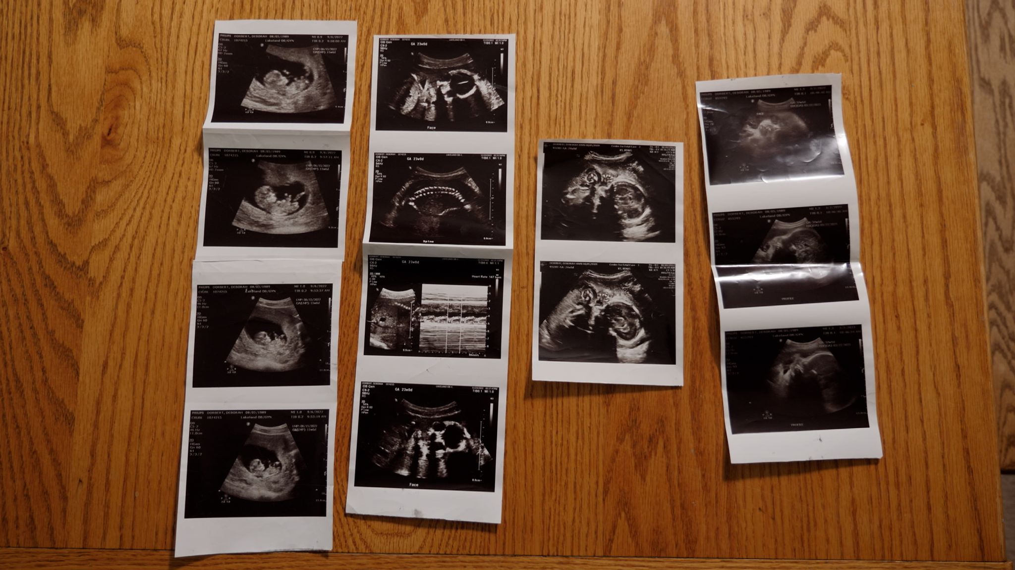 Roe v Wade: 'My baby lived for just 93 minutes' - the reality of life ...