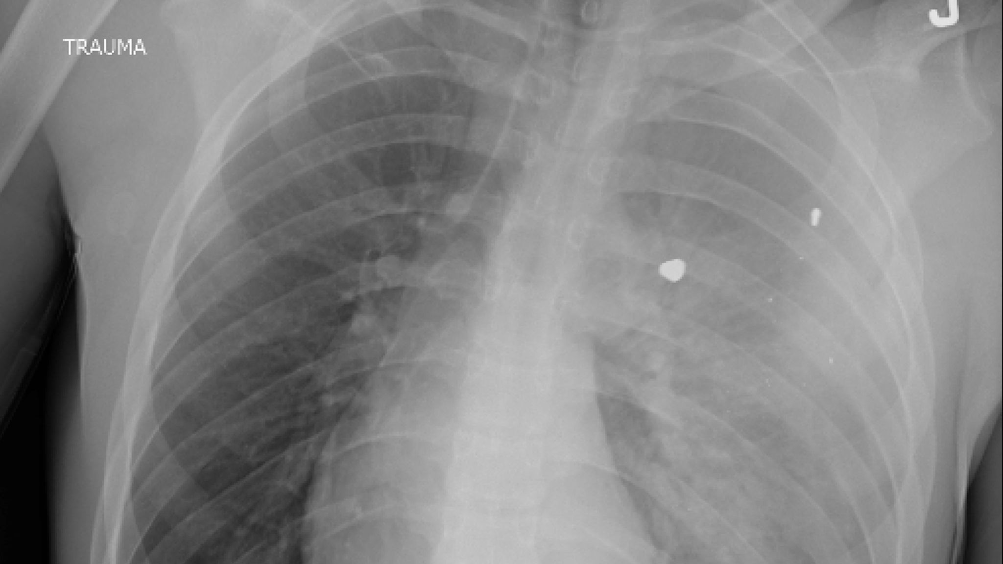 Doctor shares startling reminder guns are leading cause of death for ...