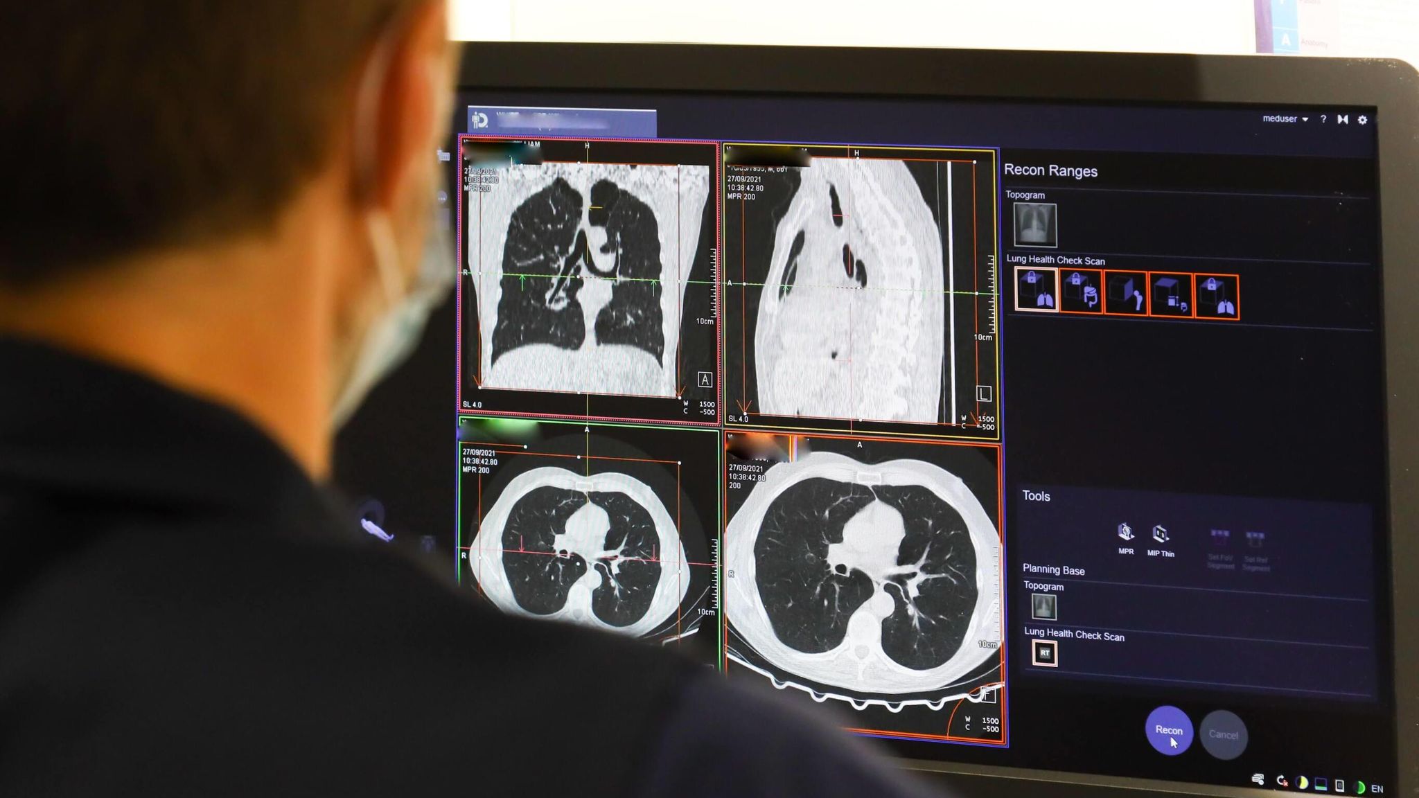 GPs given new powers to fast-track heart and respiratory checks | UK ...