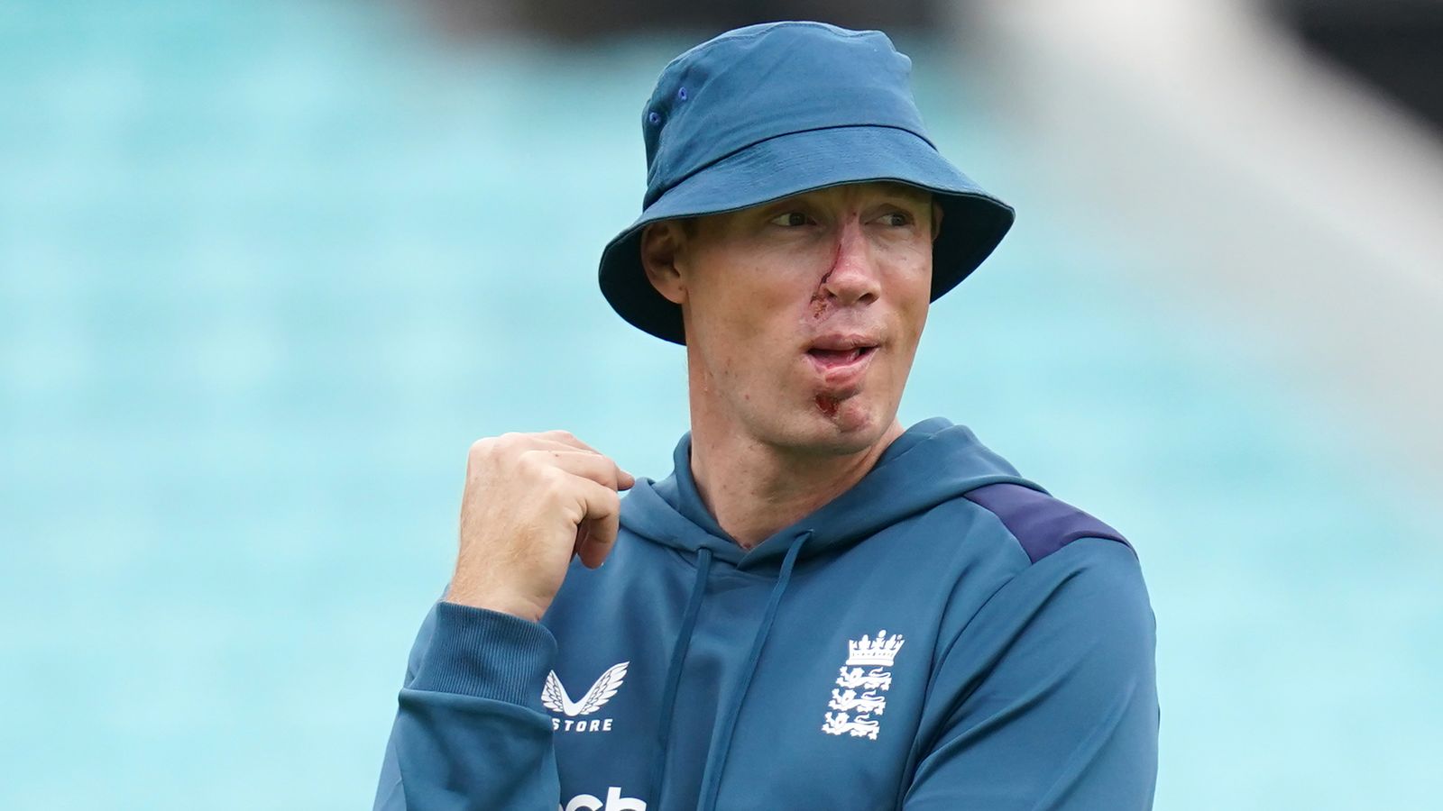 Freddie Flintoff reveals extent of injuries after Top Gear crash | Ents ...