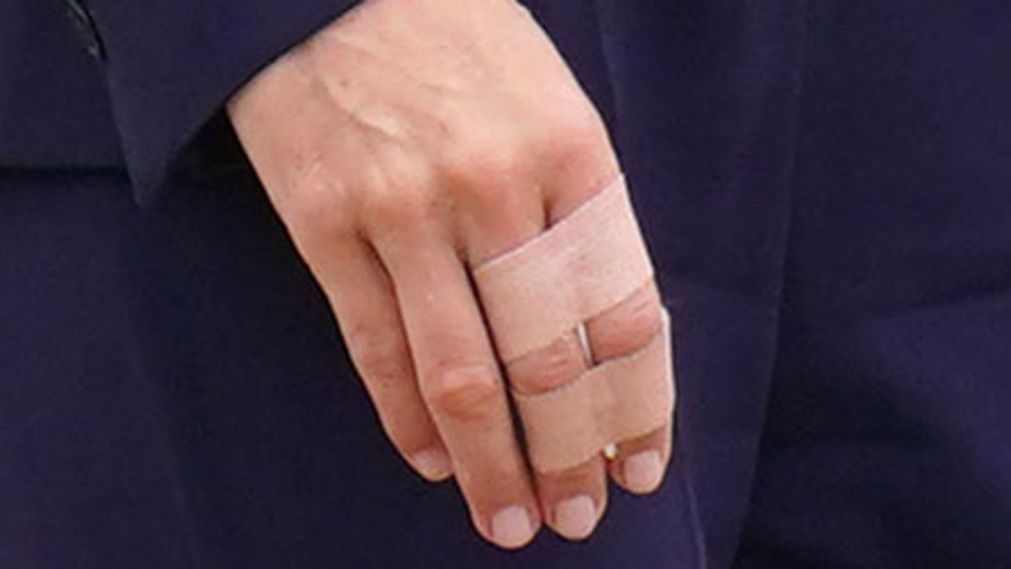 Kate reveals sports injury as she's pictured with a bandaged hand | UK ...