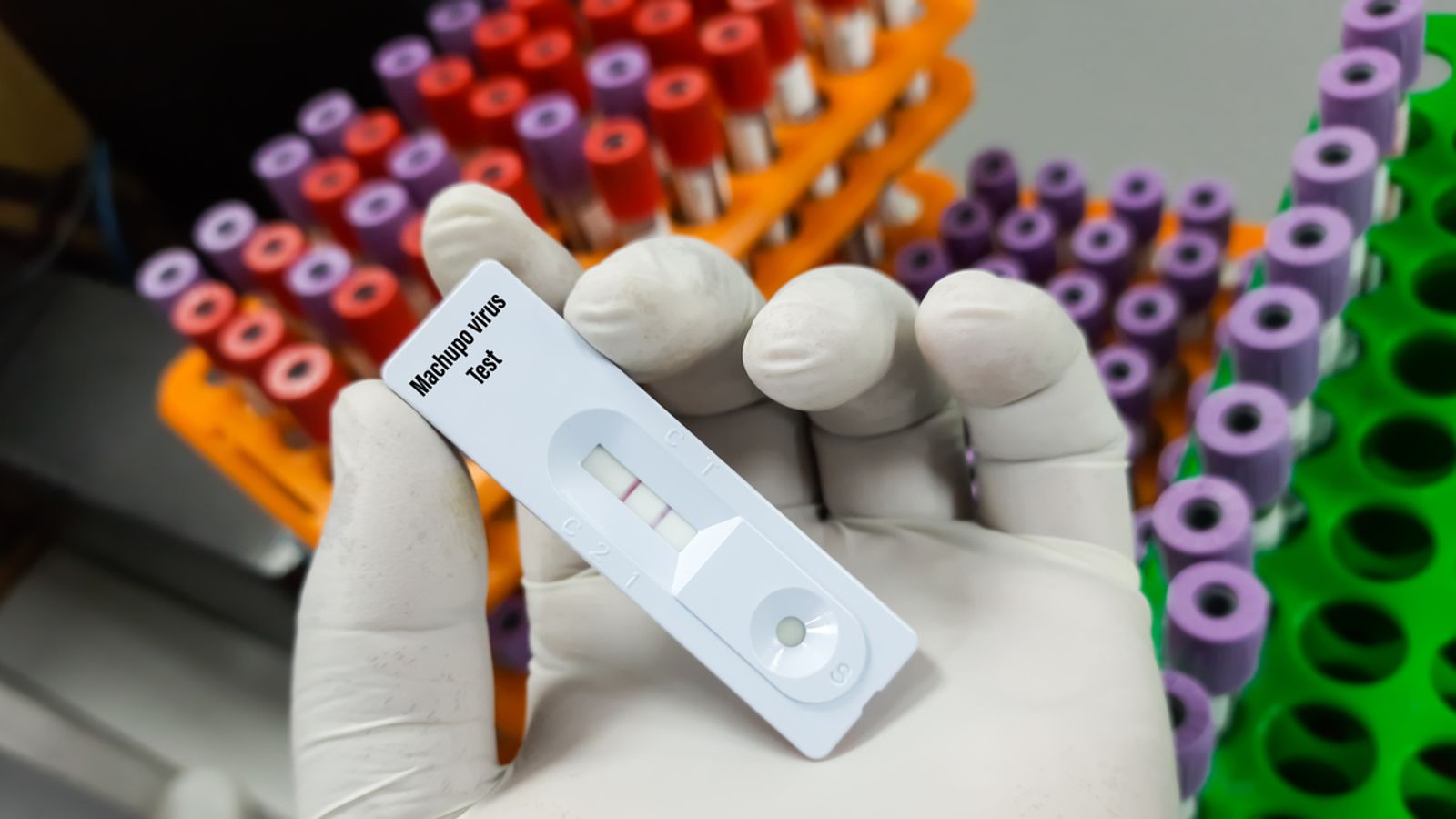 Animal-to-human diseases could kill 12 times as many people by 2050 ...