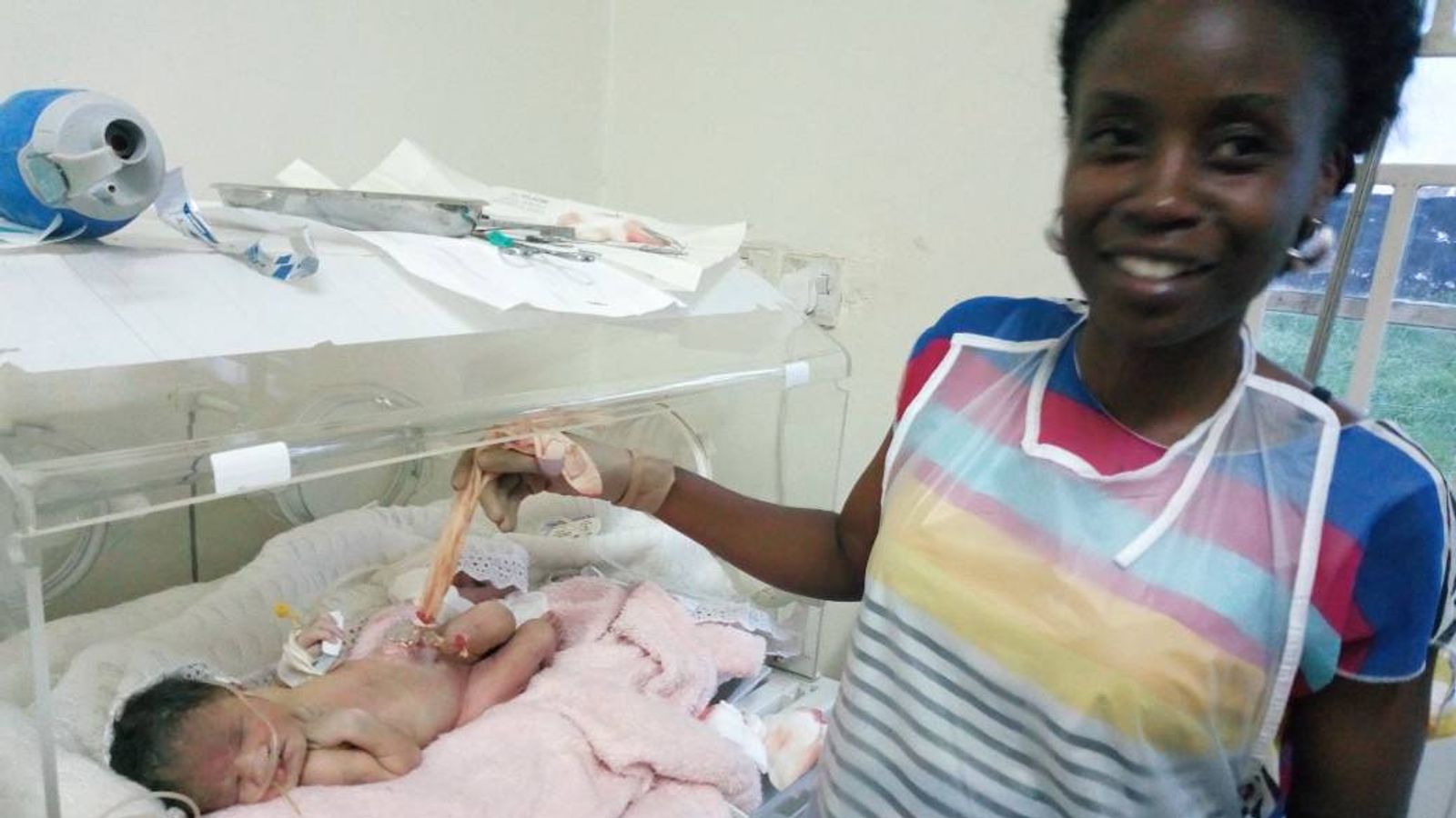 Mysterious rise in babies born in East Africa with 'guts on the outside ...