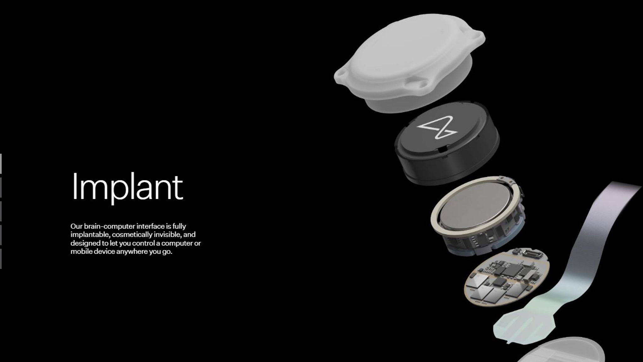 MUSK S NEURALINK IMPLANTS A BRAIN CHIP IN A HUMAN FOR THE FIRST TIME MUSK S NEURALINK IMPLANTS A BRAIN CHIP IN A HUMAN FOR THE FIRST TIME