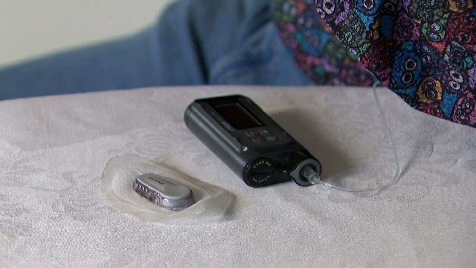 Thousands with Type 1 diabetes in England to receive 'artificial ...