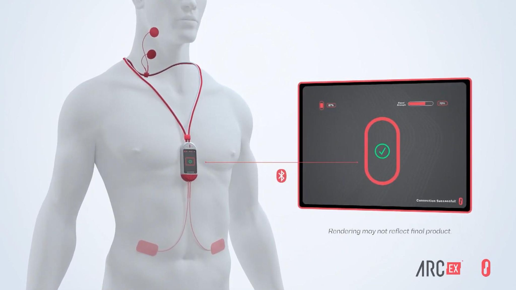 'Extraordinary' device could let paralysed people regain movement in ...