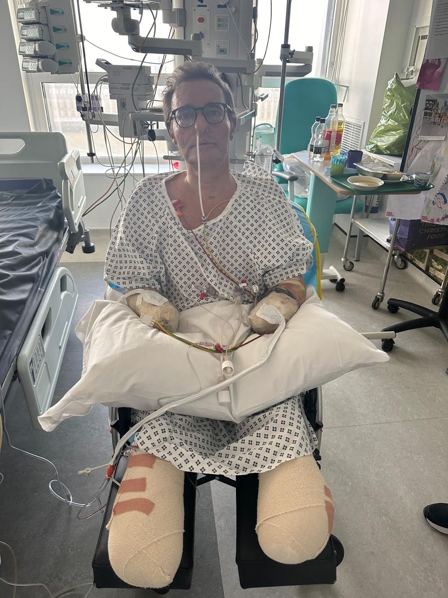 Craig Mackinlay: Tory MP reveals feet and hands were amputated after ...