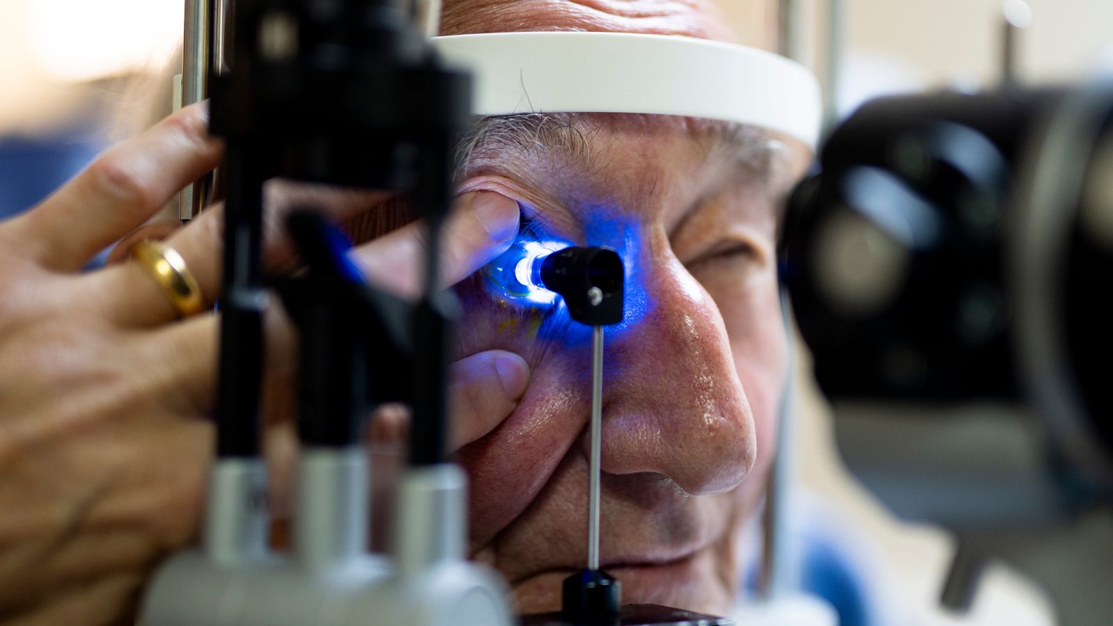 England's first artificial cornea transplant hailed a success | UK News ...